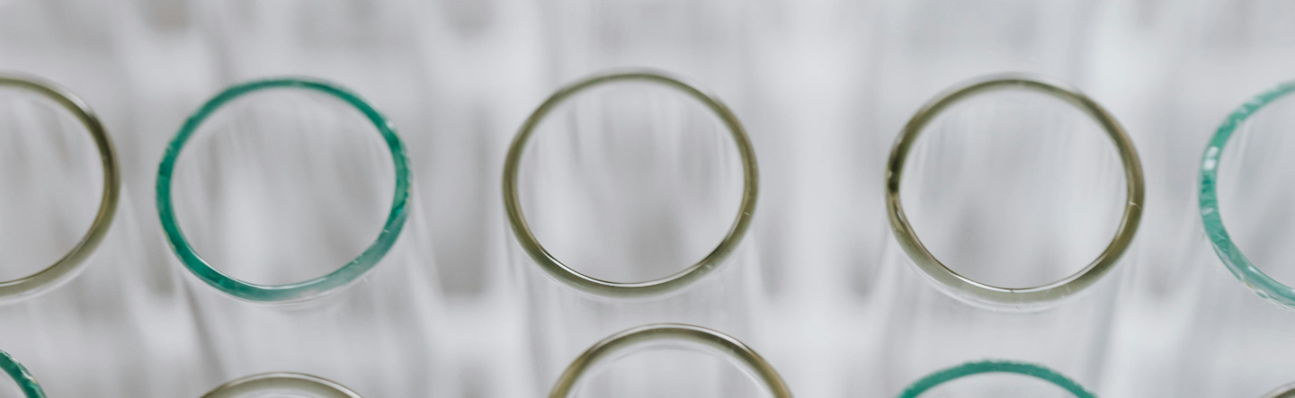 Test Management In Sap Cloud Alm The World Management